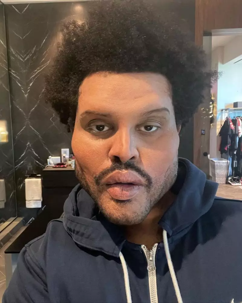 The Weeknd Cirurgia Plástica 3