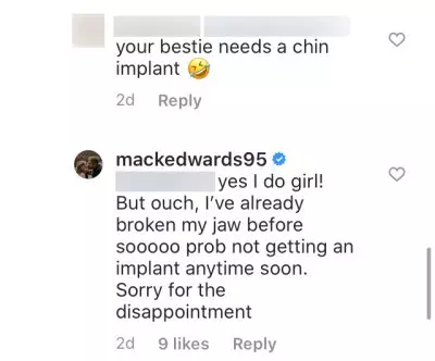 Mãe adolescente OG Star Mackenzie Edwards tem resposta perfeita ao comentarista criticando seu queixo