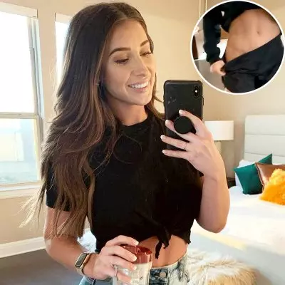 Bristol Palin mostra cicatriz de abdominoplastia que ela tinha anos atrás