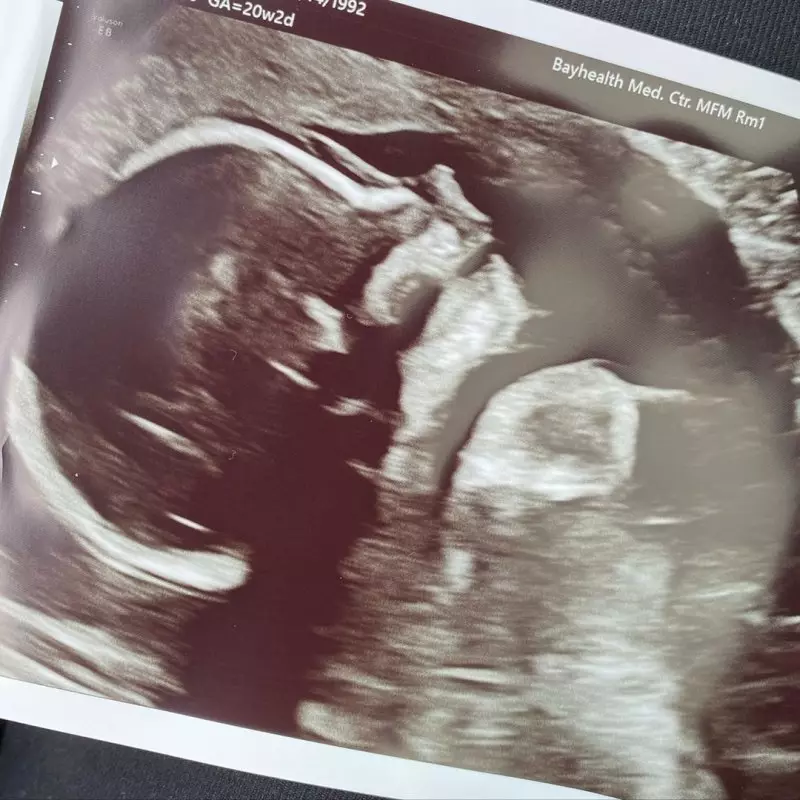 Kailyn Lowry deler 20 ukers sonogram for baby nr. 4