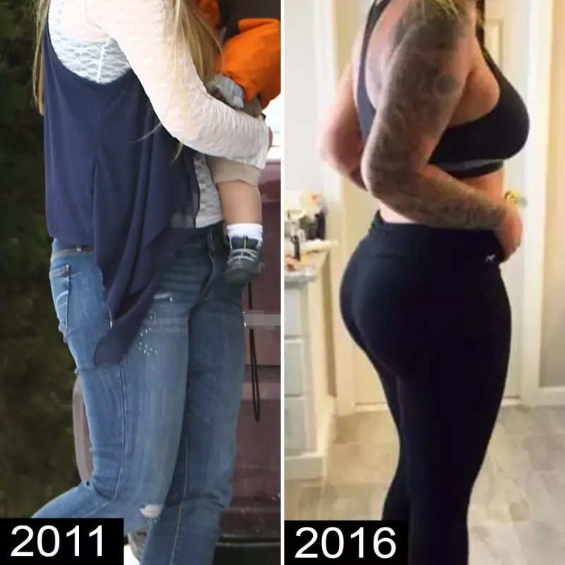 kailyn-lowry-plastik-bedah-pantat