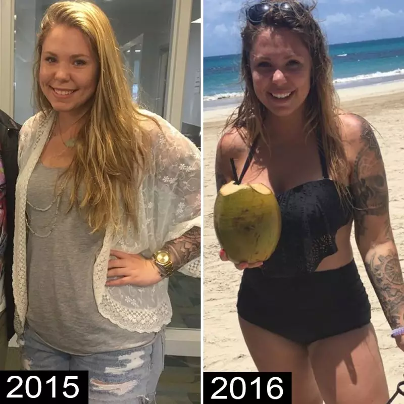 kailyn-lowry-plastická chirurgie-operace břicha