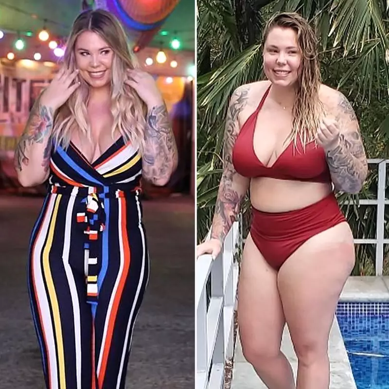 Kailyn Lowry Selalu Nyata Tentang Transformasi Bedah Plastiknya