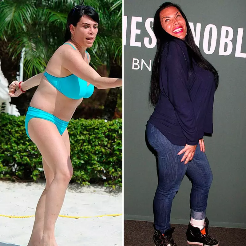 renee-graziano-butt-before-after-1