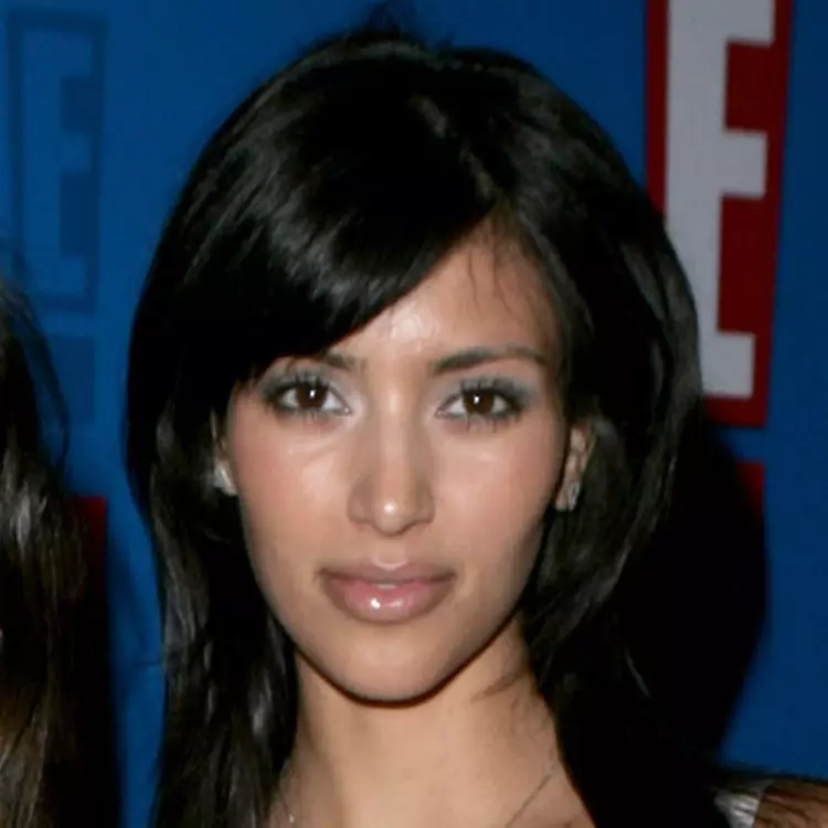 kim-kardashian-face-plastic-surgery-1-7