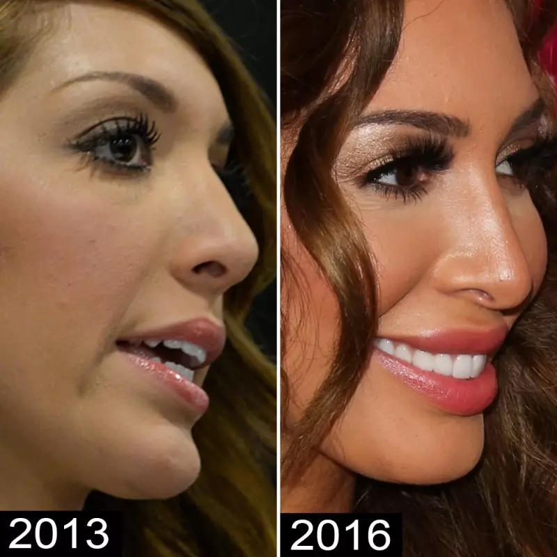 farrah-abraham-profile-chin