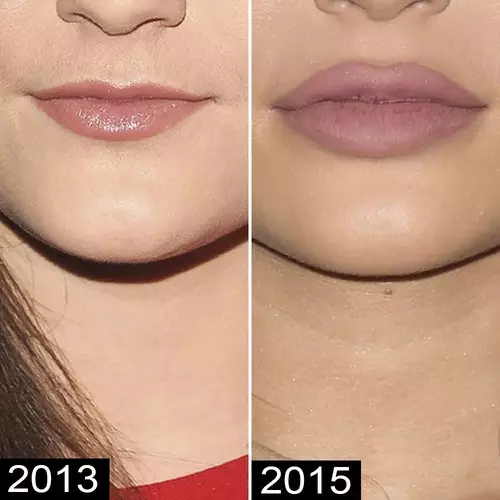 Le chirurgien plasticien de Kylie Jenner révèle tout : découvrez sa transformation choquante en photos ! - En contact hebdomadaire