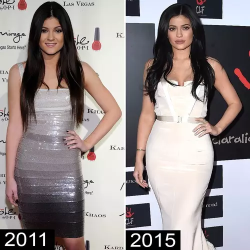 kylie-jenner-transformation