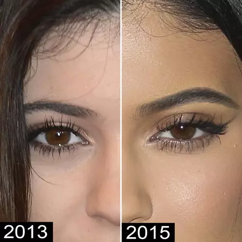 yeux de kylie-jenner