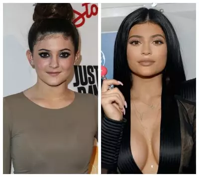 kylie jenner plastic surgery