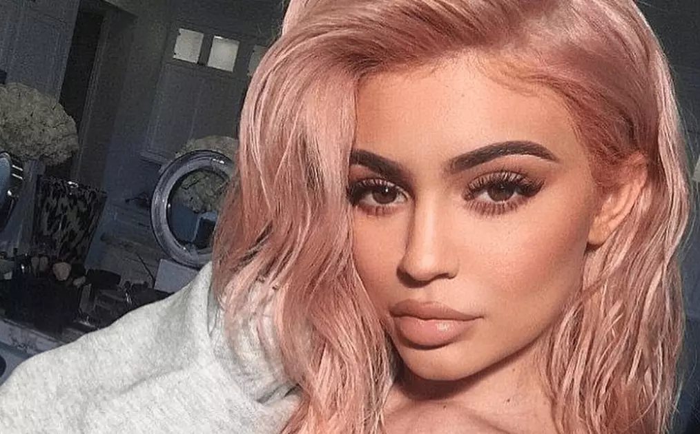 Kylie Jenner의 입술 주사: 그녀가 임시 필러를 받기로 결정한 이유