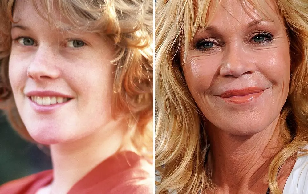 Lil 'Kim, Melanie Griffith an 10 Méi Stären déi no Plastesch Chirurgie onerkennbar ausgesinn - In Touch Weekly