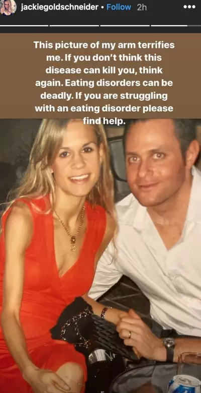 jackie-Goldschneider-eating-disorder-ig